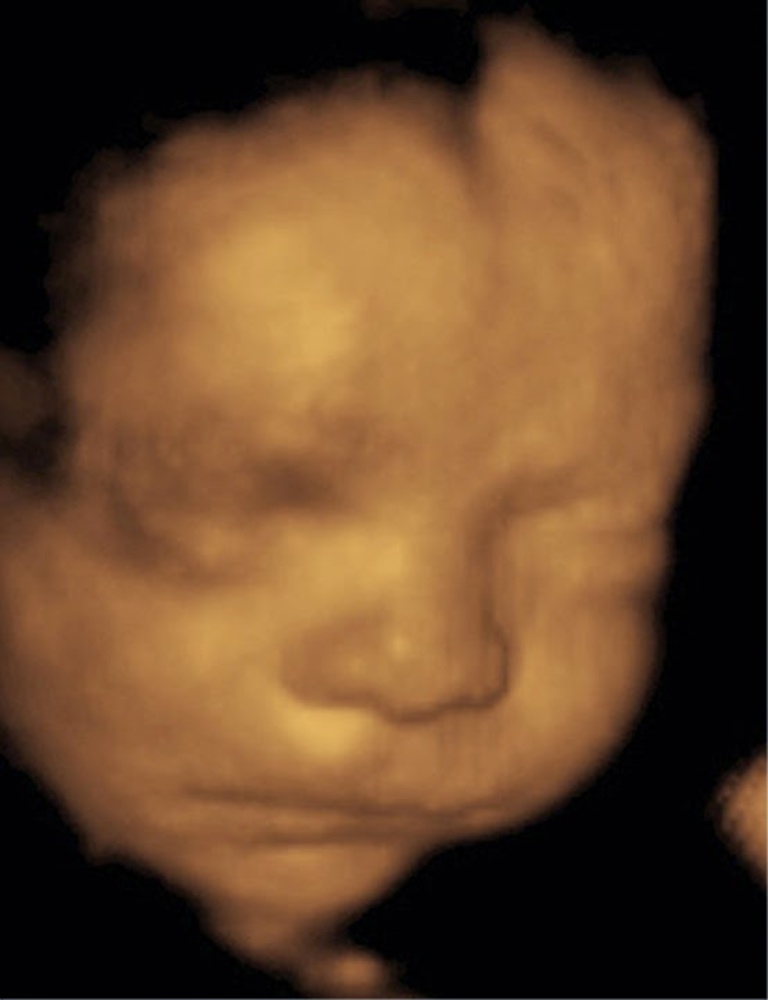 2d 3d 4d Ultrasound at Backs, Babies, & Bellies on Lambert St in Lake ...